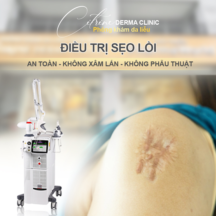 ĐIỀU TRỊ SẸO - Thẩm mỹ CITRINE DERMA CLINIC