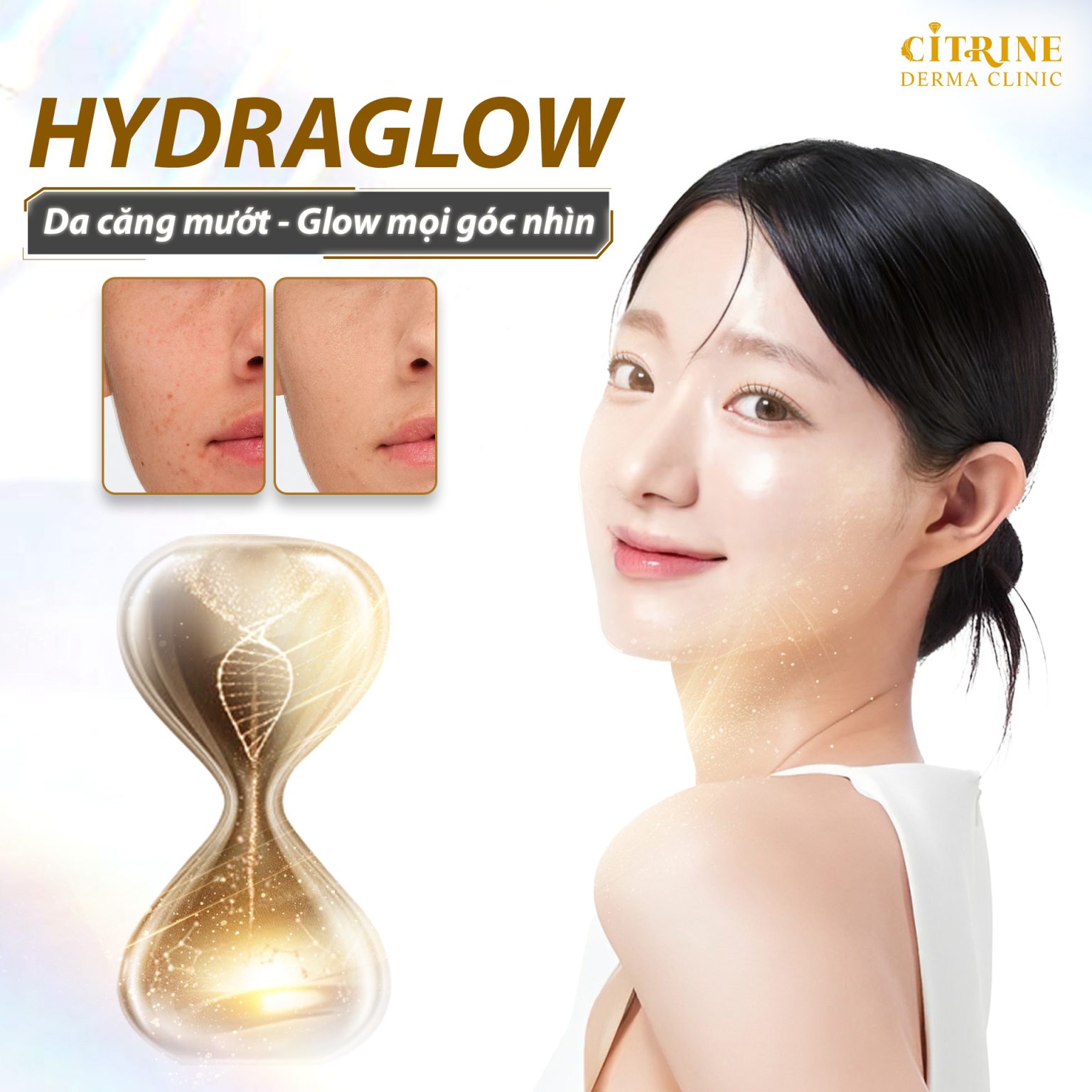 HydraGlow – Tiêm Meso Cấp Nước Tức Thì, Da Căng Bóng Trắng Sáng Từ Lần ...