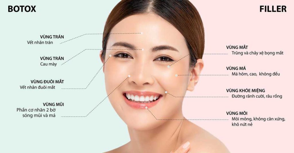Filler & Botox Chuẩn Y Khoa - Trẻ Hoá Da Tự Nhiên Không Cần Phẫu Thuật ...